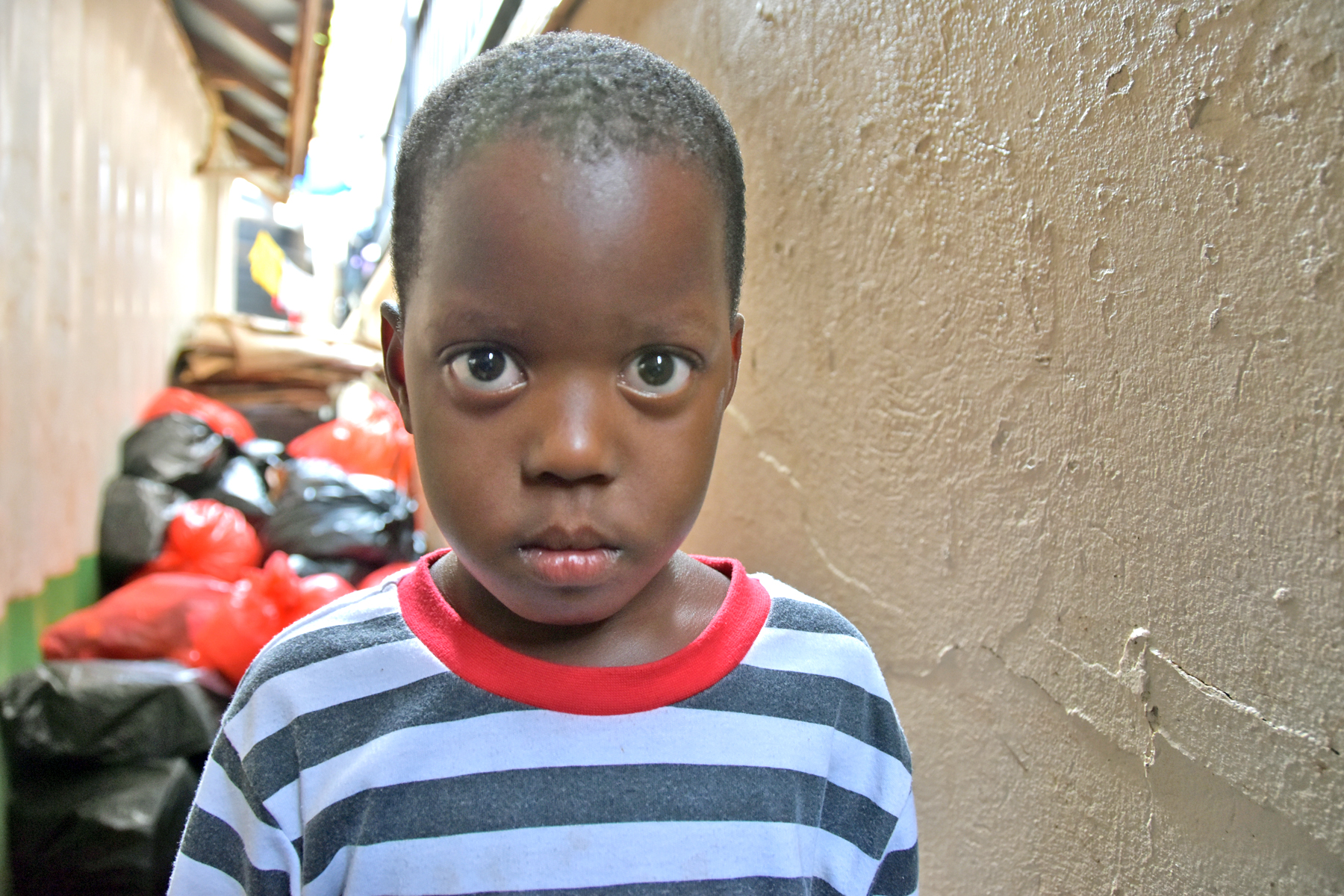 Kintu can now breath properly after adenoid surgery 🩺 - Humanity Direct