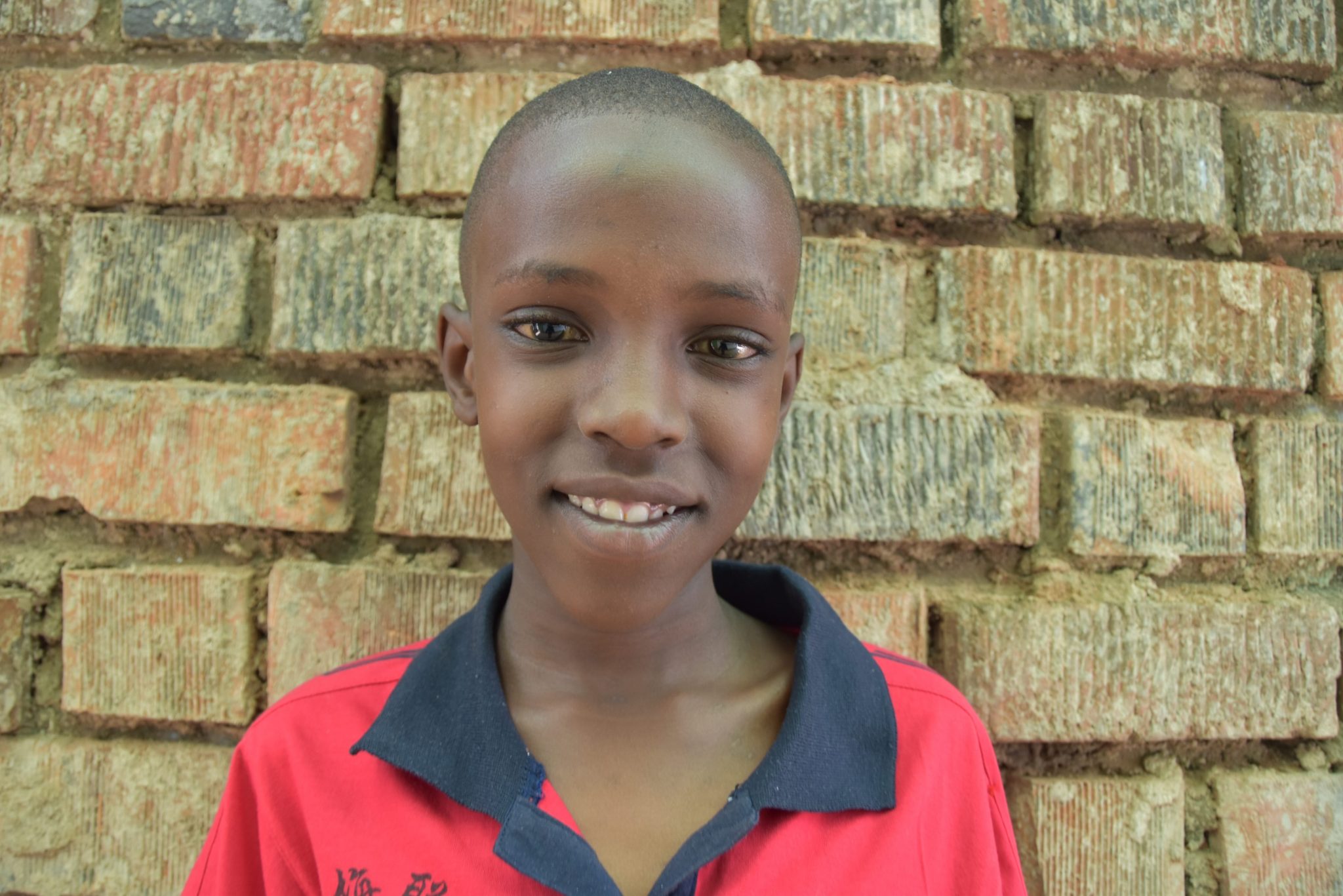 Richard has made a great recovery following his surgery - Humanity Direct